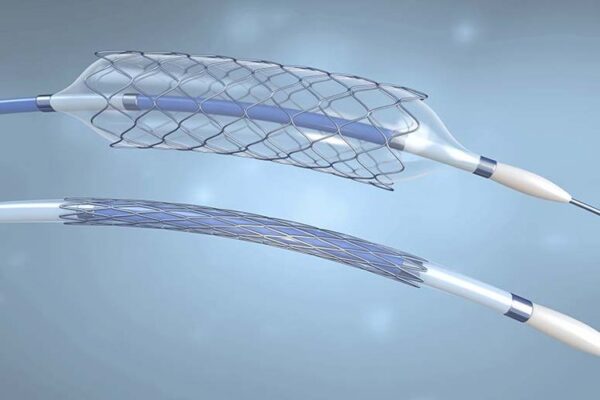 Understanding the Basics of Endovascular Surgery | Coastal Vascular