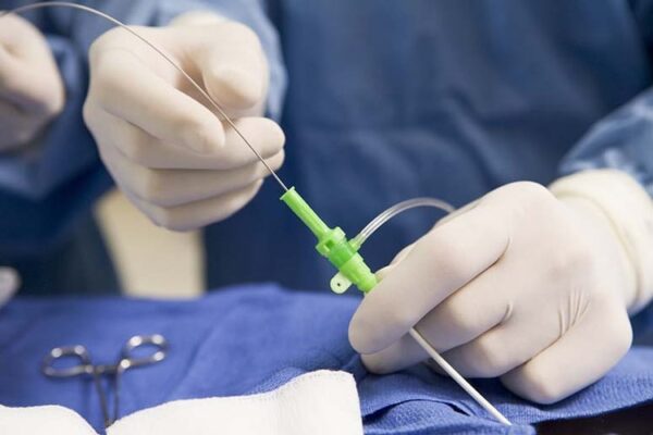 Understanding the Basics of Endovascular Surgery | Coastal Vascular